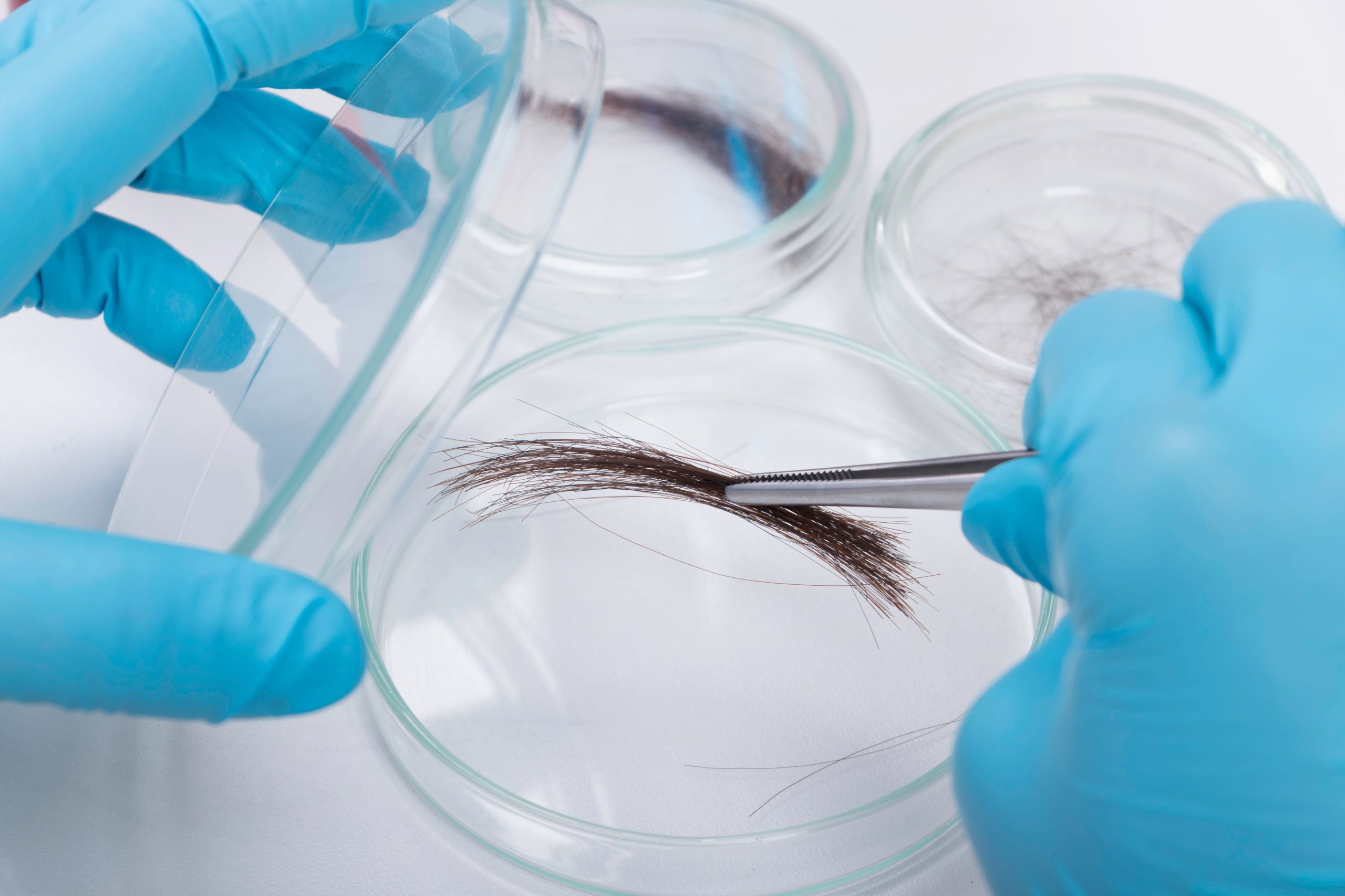 Can you do a DNA test with hair?